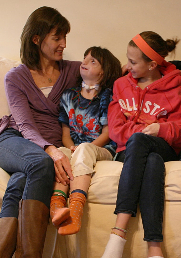 Clara's struggle: Girl with deformed face wants to be 'like the other kids'