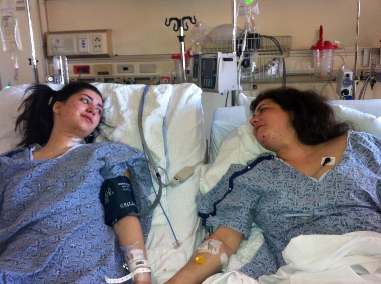'Rapid strides': Limb advances offer hope for Boston amputees