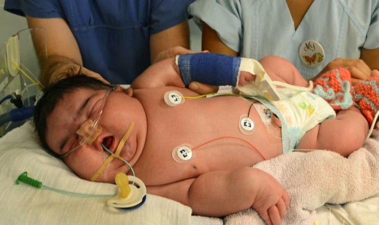 Big Baby Boom Supersize Deliveries Have Doctors Worried