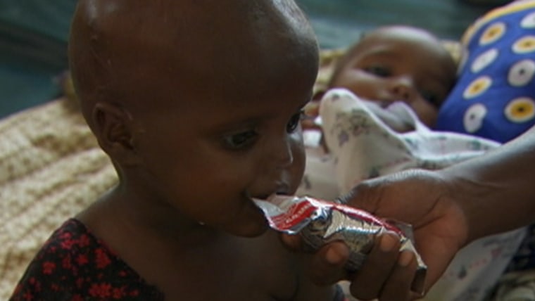 Plumpy’nut: Saving lives half a world away