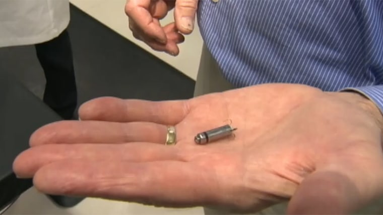 World's Smallest Pacemaker Implanted