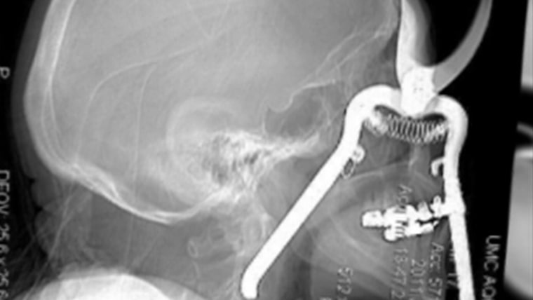 'The pain was so bad that I guess I wasn't afraid to die'