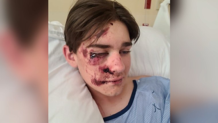 Teen survives nearly 100-foot fall at Grand Canyon