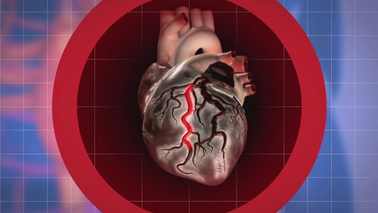 Heart Attacks In Young People On The Rise: Healthy 38-Year-Old Speaks Out