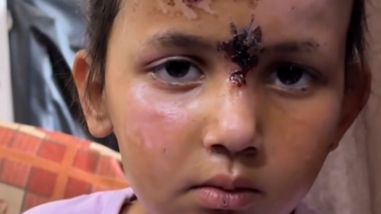 Wounded children treated in Gaza hospital