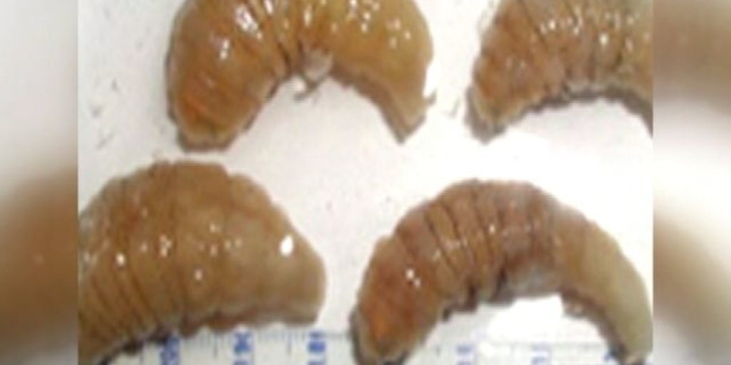 maggots in human stool