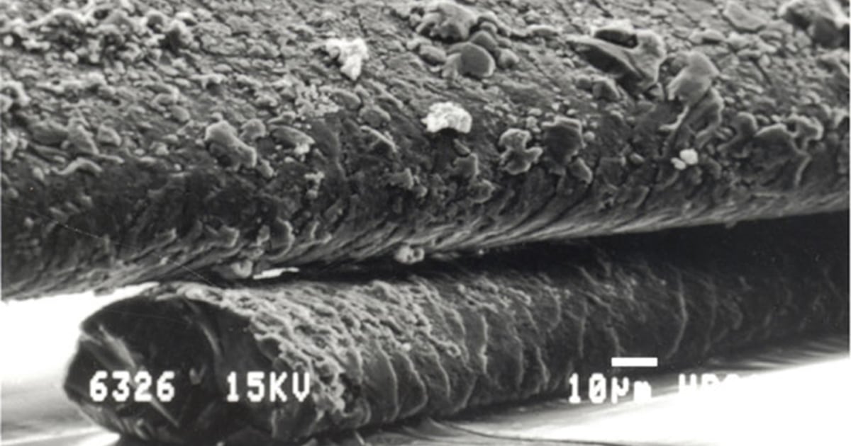 Human hair found in prehistoric hyena poop