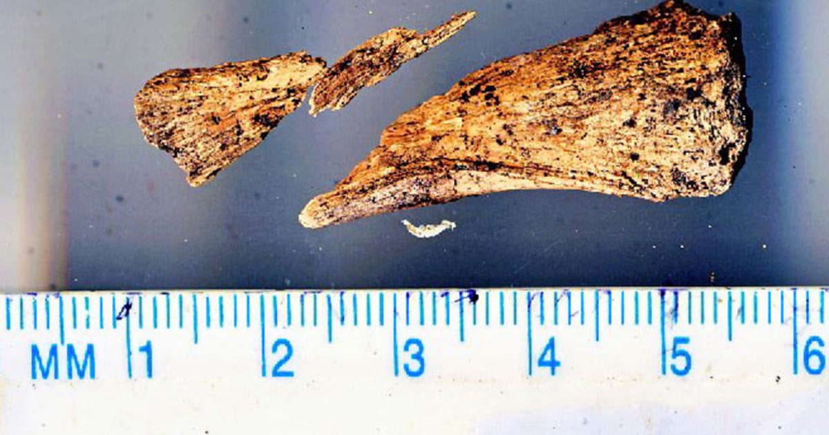 Amelia Earhart's finger bone recovered?