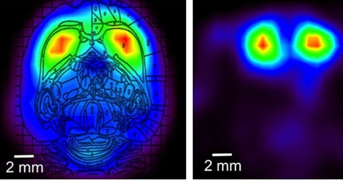 So here's how a rat's brain works in the rat race