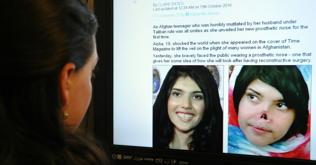 Only suspect in Afghan mutilation case goes free