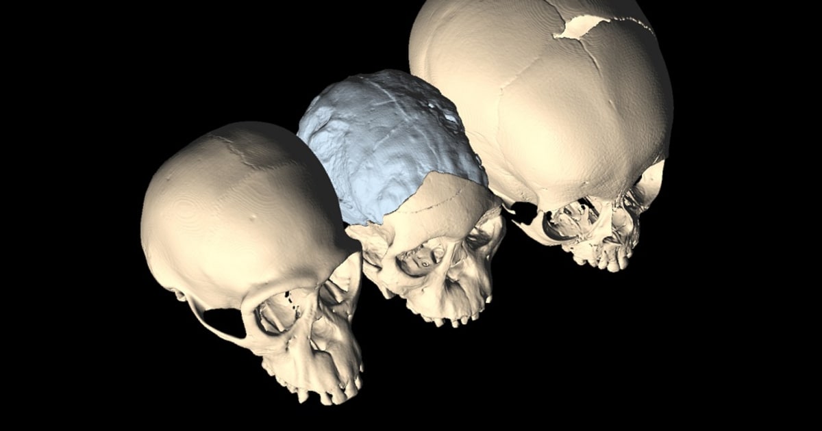 Our ancestors' squishy skulls led to bulging brains