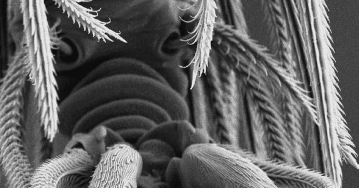 spider under electron microscope