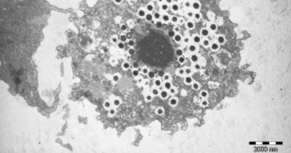 Giant viruses are ancient living organisms, study suggests
