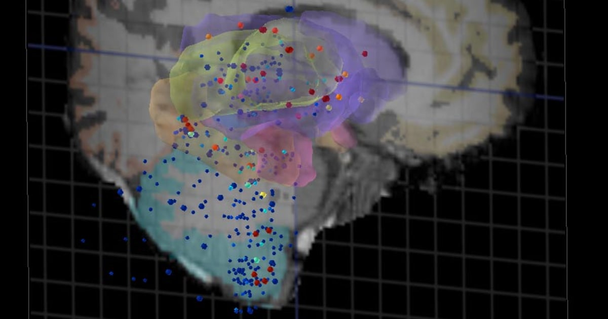 New atlas may help solve mysteries of the human brain