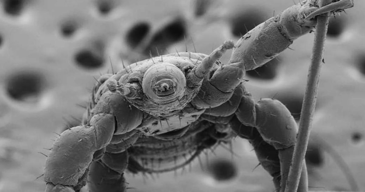 flea under electron microscope
