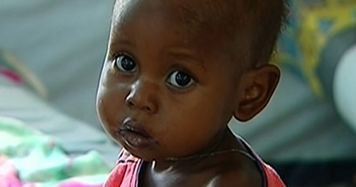 In famine, children hit hardest