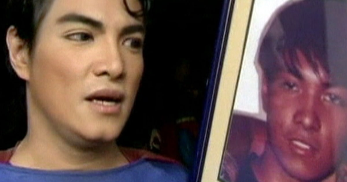 Plastic surgery for Superman look-a-like