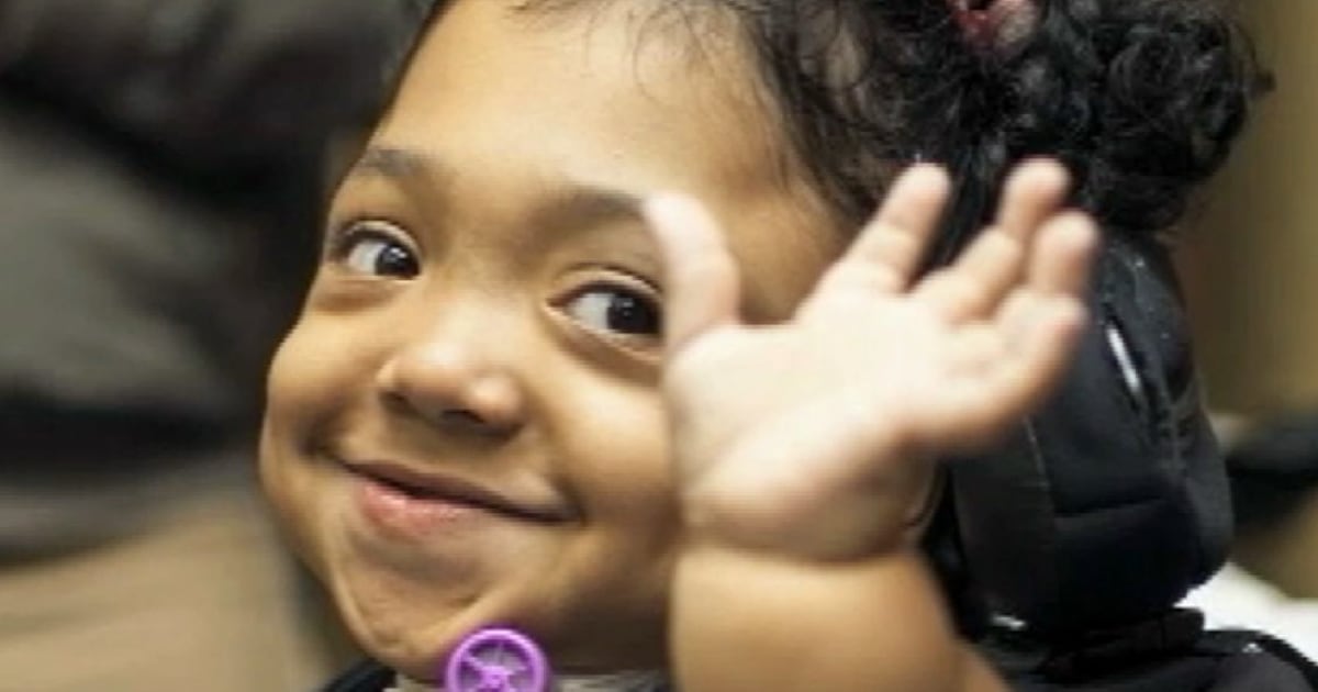 New hope for girl born without bones