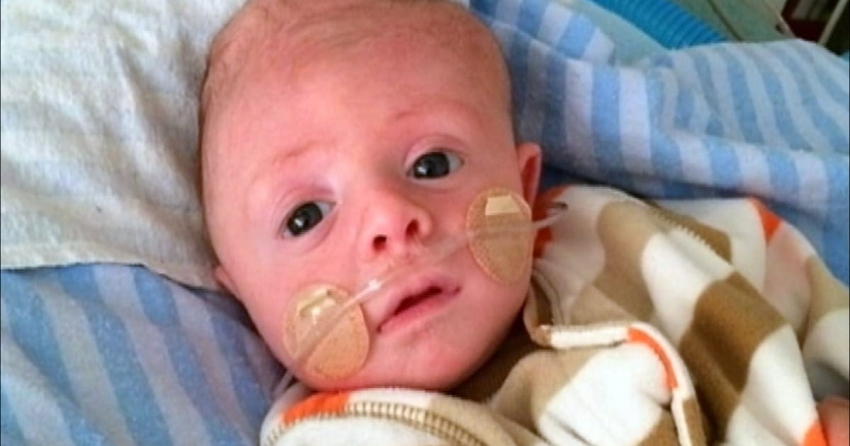 7-Pound Growth Removed from Baby's Head