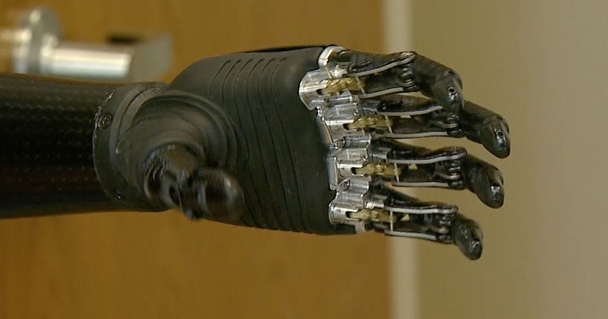 This Double Amputee Has Robotic Limbs That He Can Control with his Thoughts