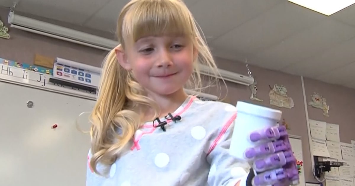 3-D Printer Creates New Hand For Young Girl