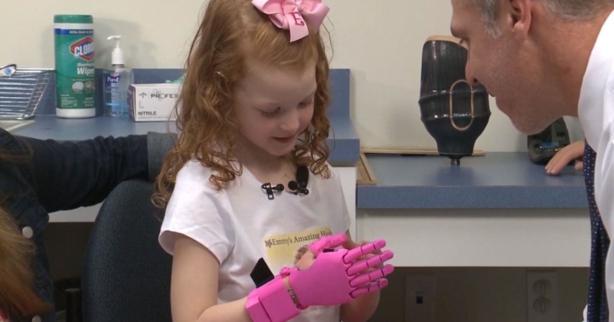 Girl Gets Prosthetic Hand Made From 3-D Printer
