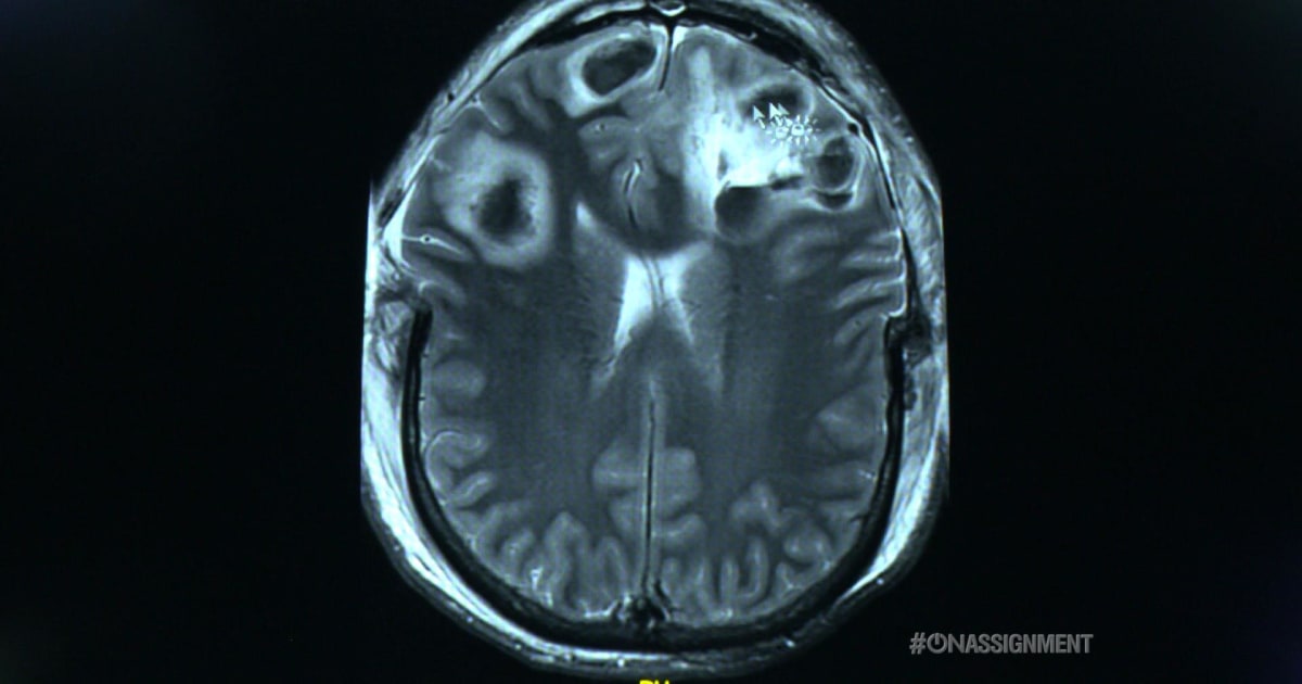 Life or Death Decisions: The Brain’s ‘Self-Repair” Process May Go On ...