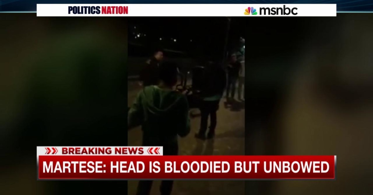 UVA's Martese Johnson speaks out