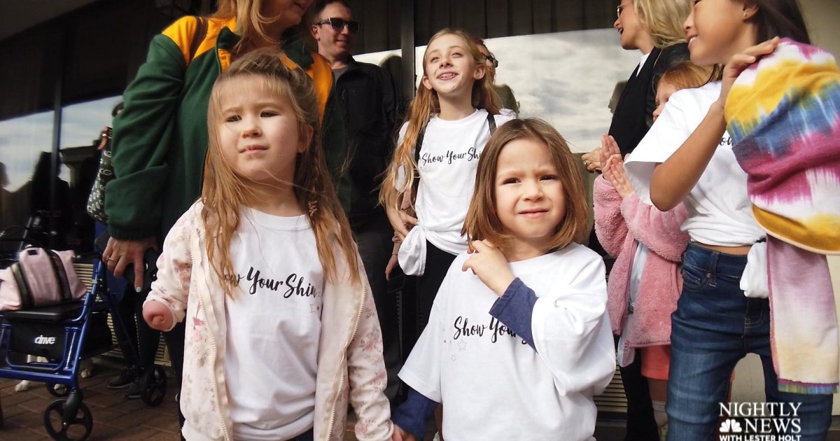 Amputee fashion show inspires more than its models (Part 1)