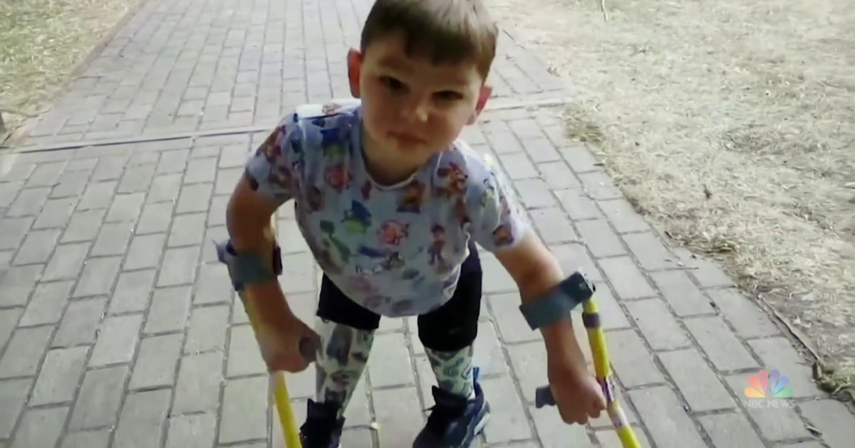 5-year-old double amputee raises over $1 million for London hospital