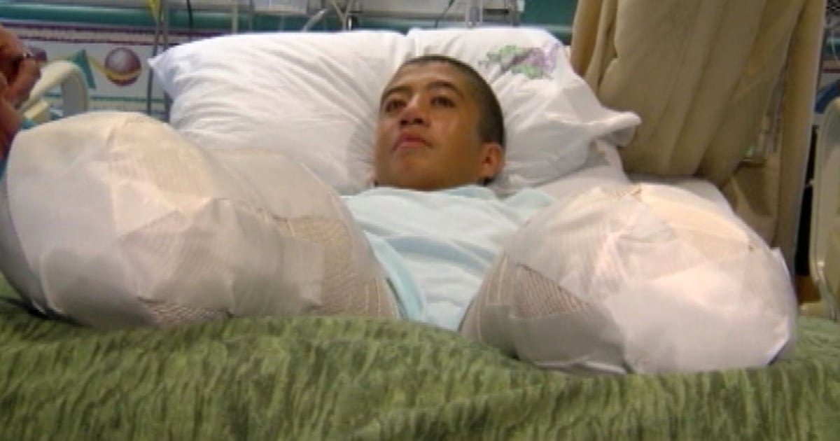 Teen battling genetic condition amputates legs