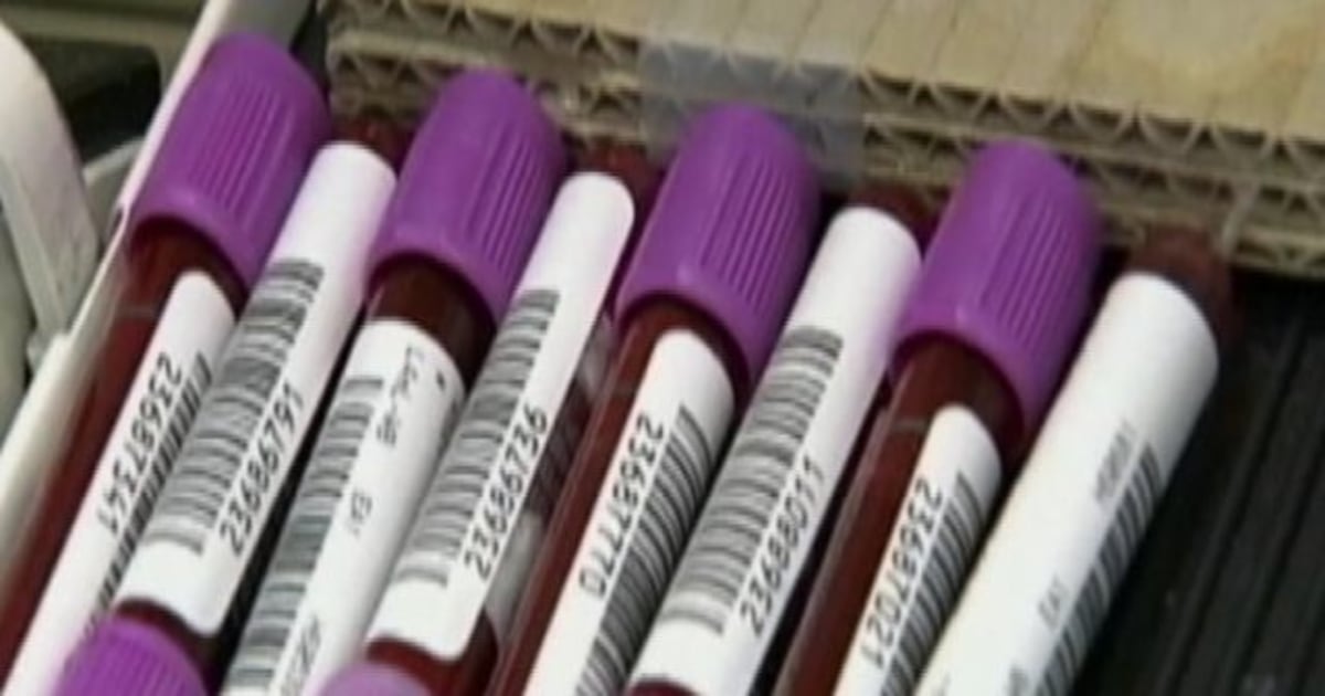 Blood test may help diagnose autism early