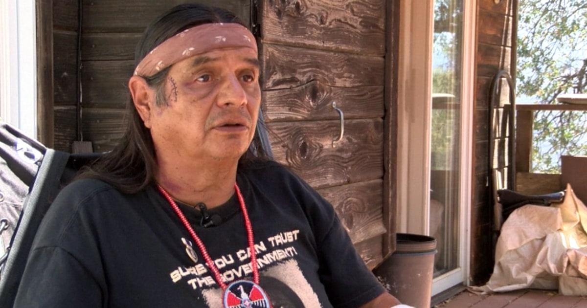 Bear Attack Victim Tells Survival Story