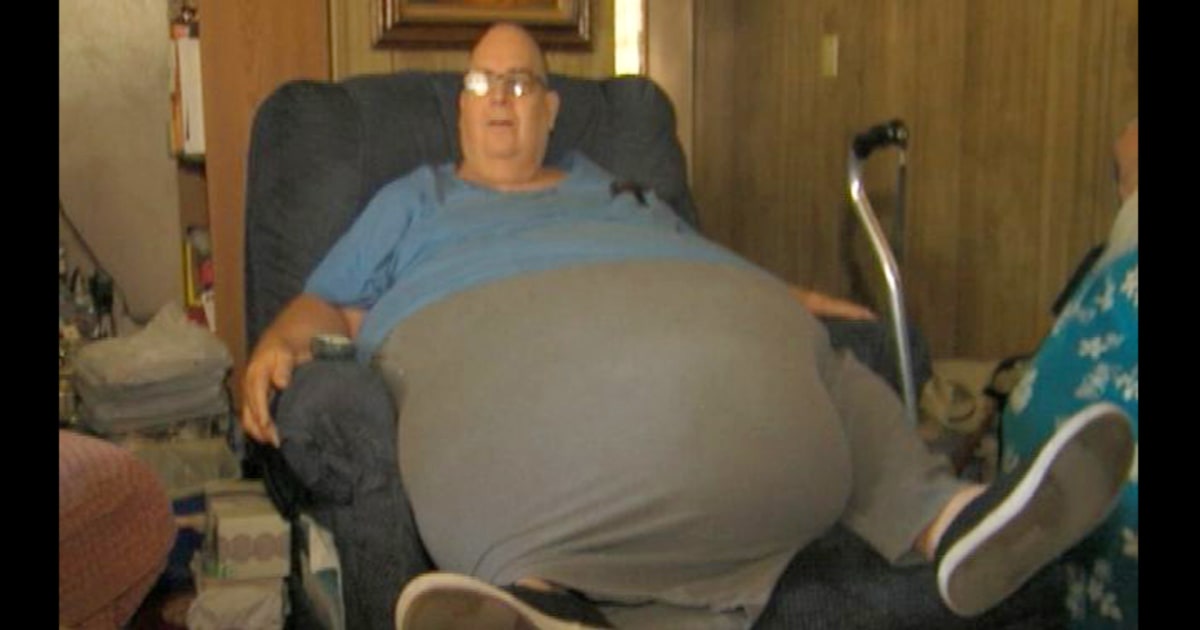 Doctors remove 200-pound tumor from man’s torso