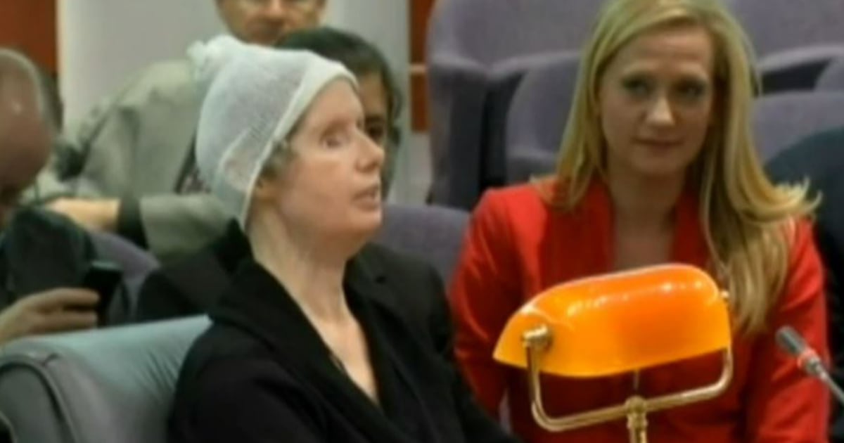 Chimp Attack Victim Charla Nash Seeks to Sue State for $150M