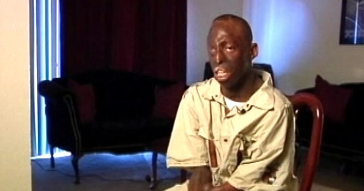 Man with no hands banned from roller coaster