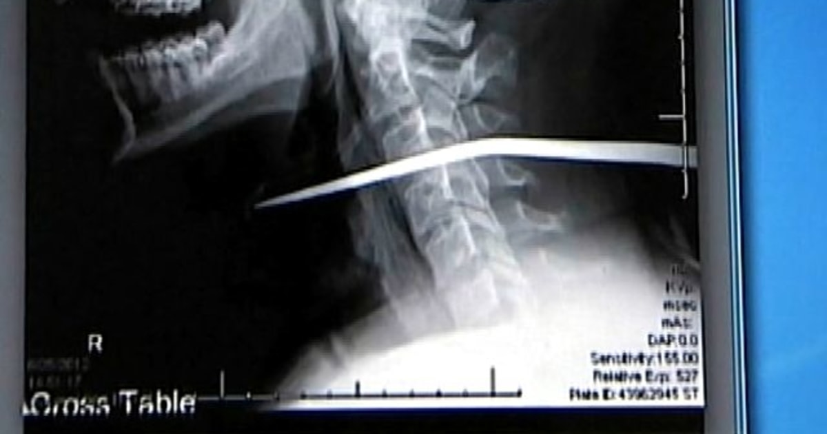 Shank through neck nearly hits spinal cord