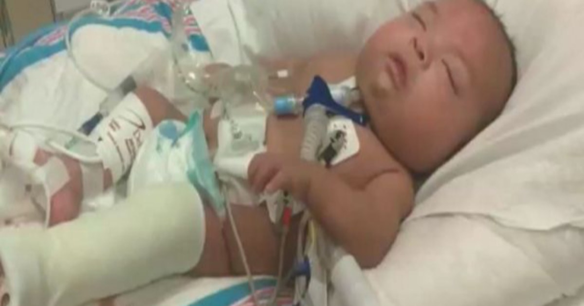 Nurse Snips Off Baby's Toe