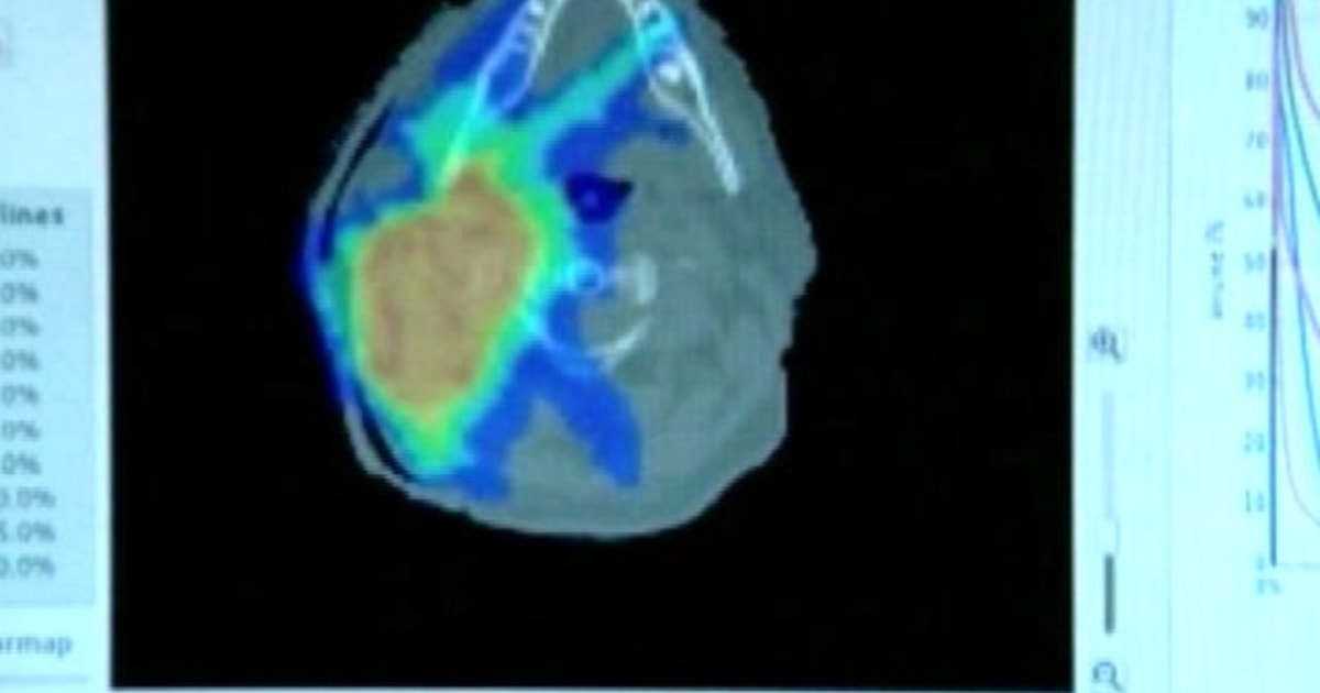 Gaming technology helps fight cancer