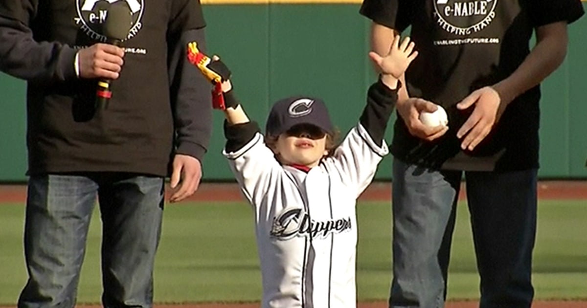 Boy with New, 3D-Printed Hand Throws Out First Pitch