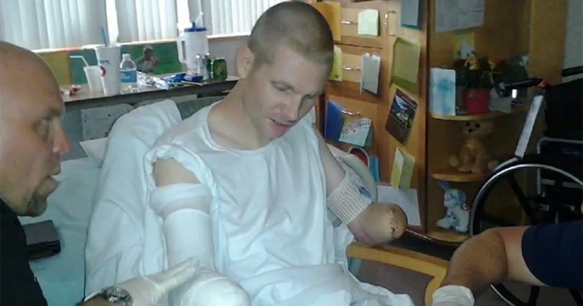 Man Loses Arms to Homemade Fireworks