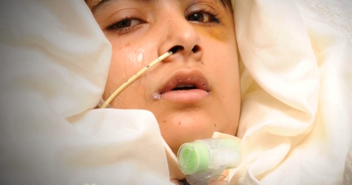 Malala Yousafzai wakes from coma