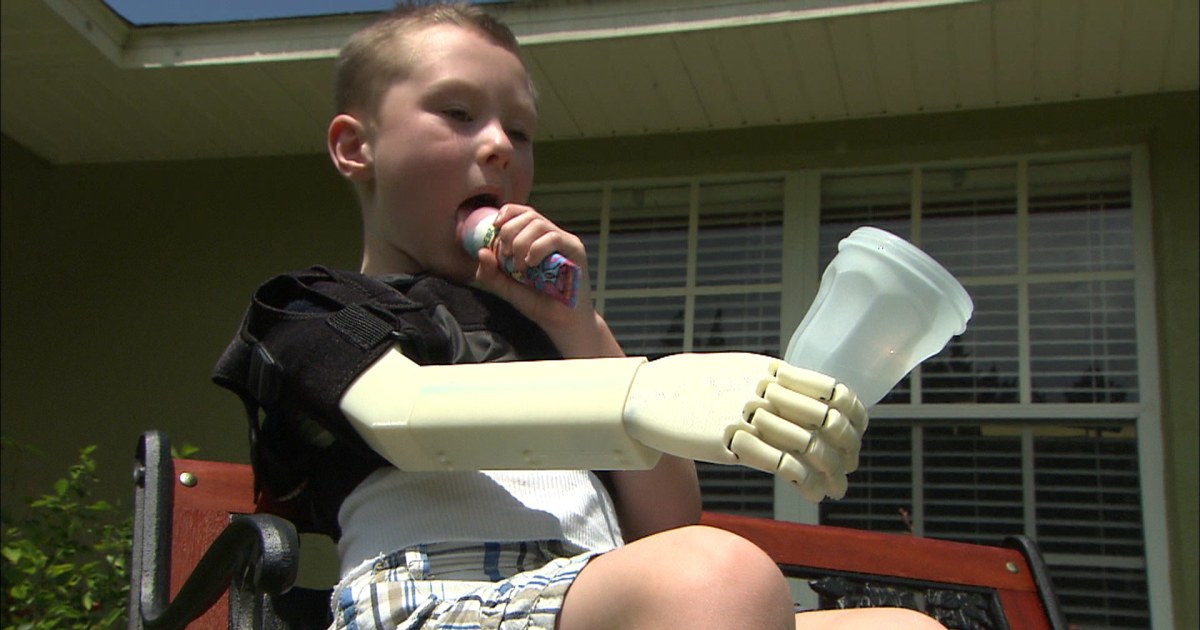 College Students Build Boy Bionic Arm