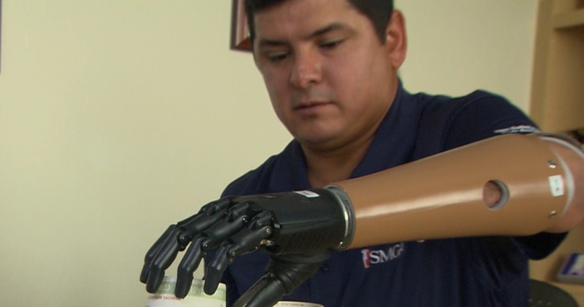 New prosthetics have built-in features