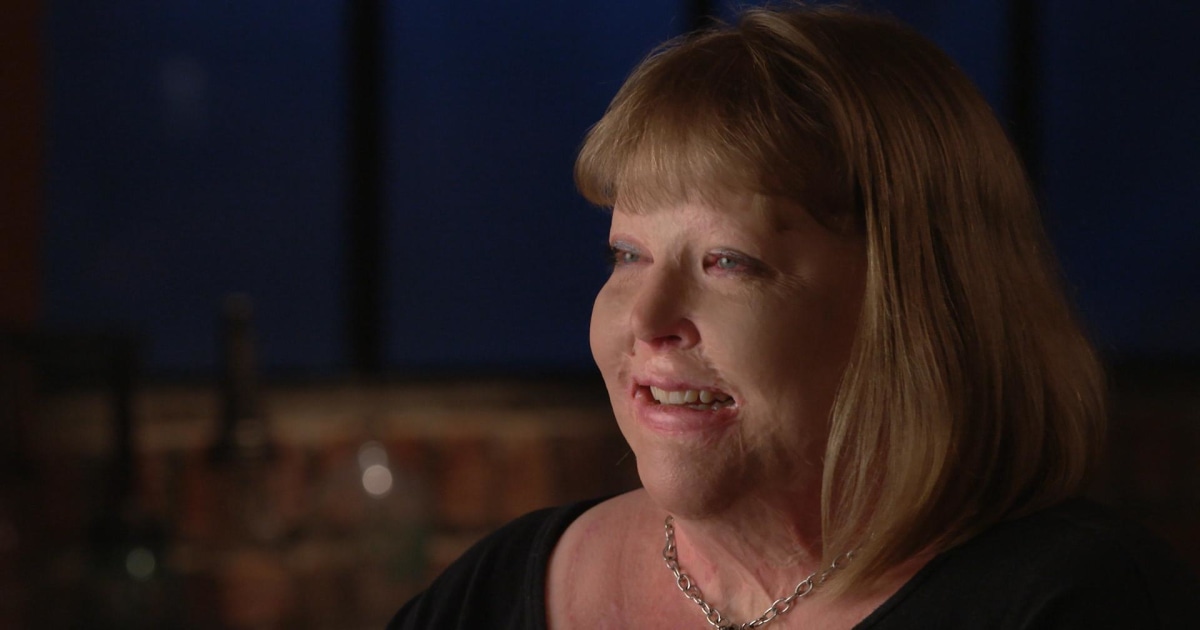 Survivor Allyson Roach: The day I was finally able to heal