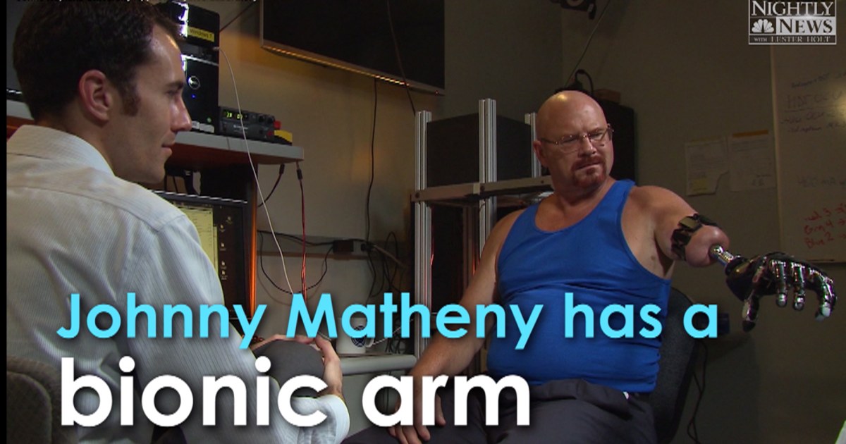 Meet the Man Who Has a Thought-Controlled Robotic Arm