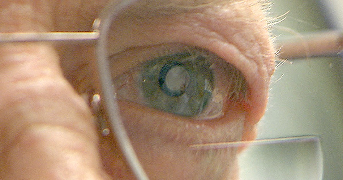 Hindman: 'No one knows the potential of this telescopic eye'