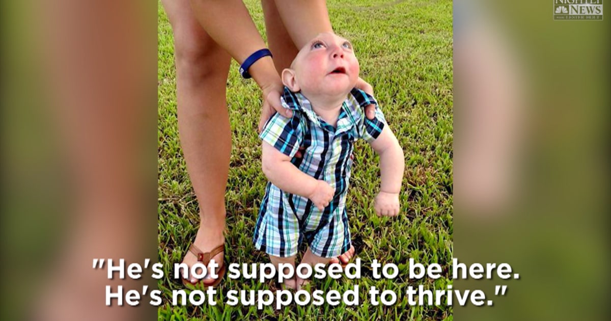 The Incredible Survival Story of a Boy Missing Part of His Brain