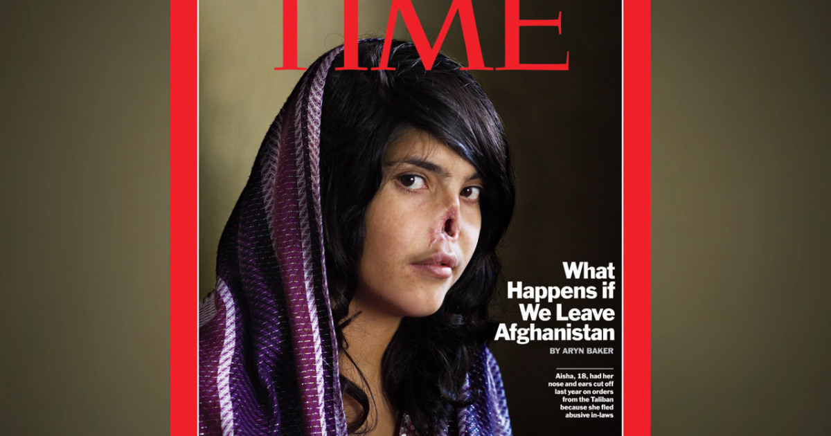 Aesha's journey to a new life and face