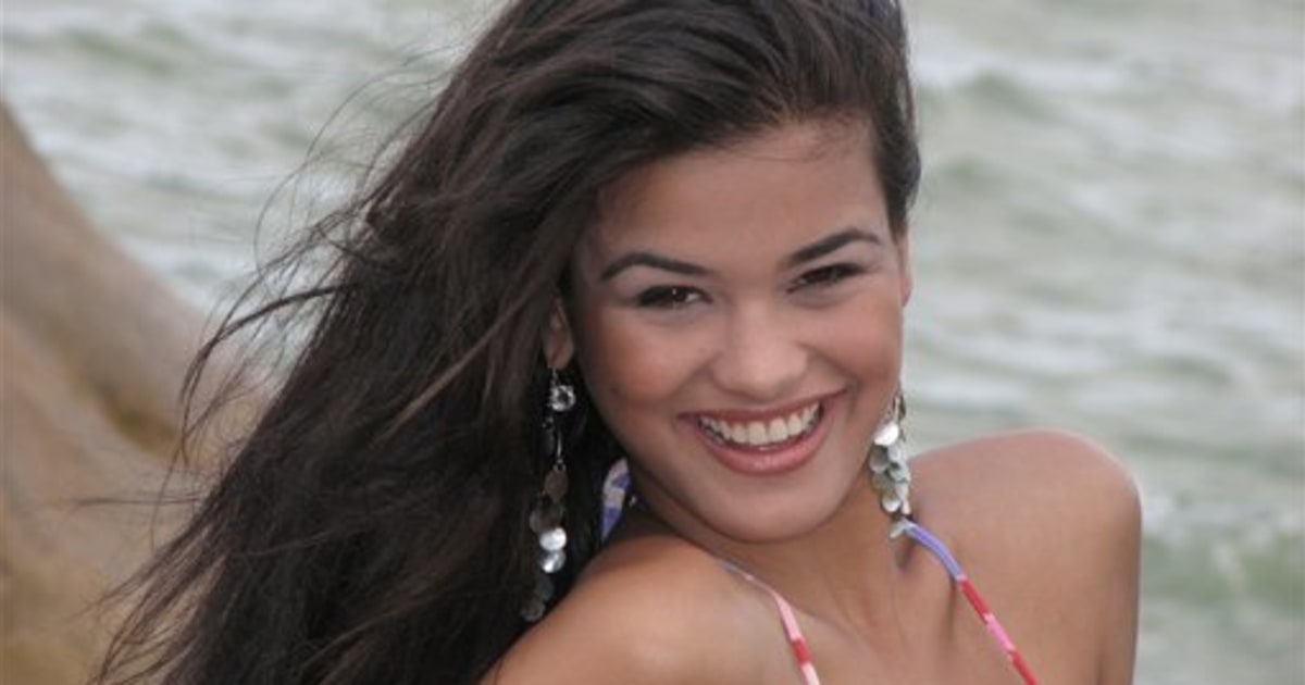 Brazilian model loses fight for life
